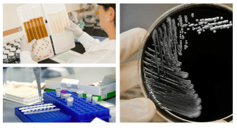 COMPARACIÓN ENTRE CULTIVO, LEGIOLERT Y qPCR PARA LEGIONELLA PNEUMOPHILA ...